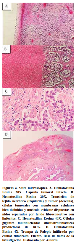 Disgerminoma de ovario con componente sincitiotrofoblástico en una ...