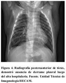 Tratamiento conservador del quilotórax posquirúrgico en paciente ...
